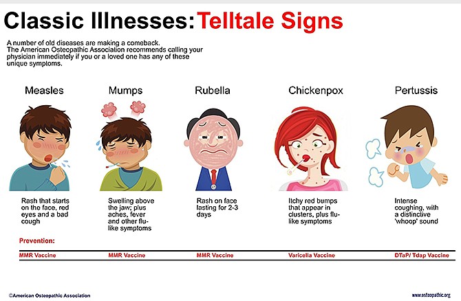 What to do? Some questions, answers about measles at work | Jefferson ...