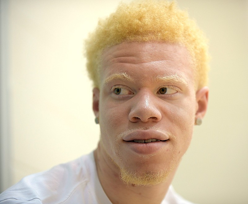 'Everybody's different': TCU athlete with albinism embraces his life ...