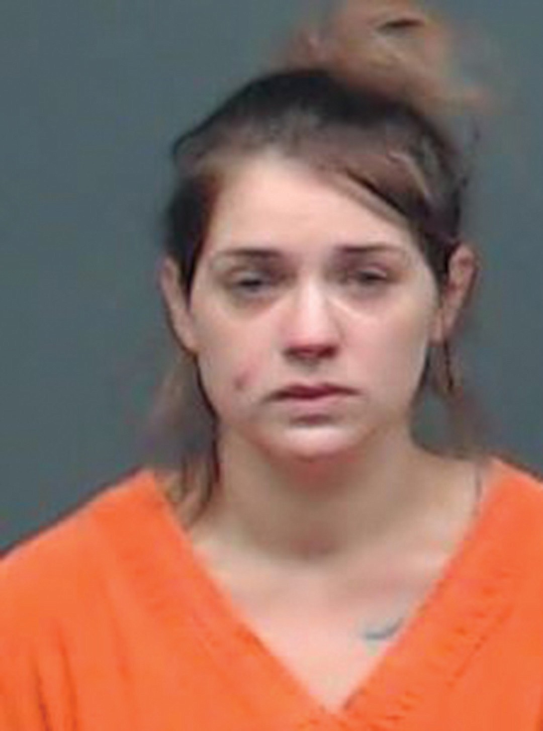 Autopsy findings discussed in case of pregnant mother and unborn child ...