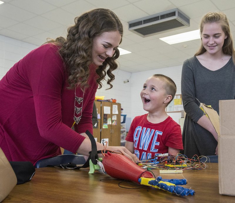 Video: Rogers kindergartner tries prosthetic arm made by Harrison ...