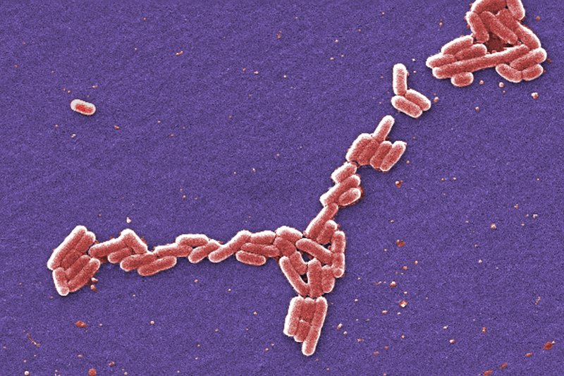 1st death reported in E. coli outbreak