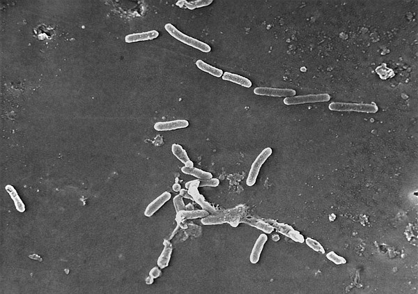 Estimate of 'superbug' deaths rises | Northwest Arkansas Democrat-Gazette