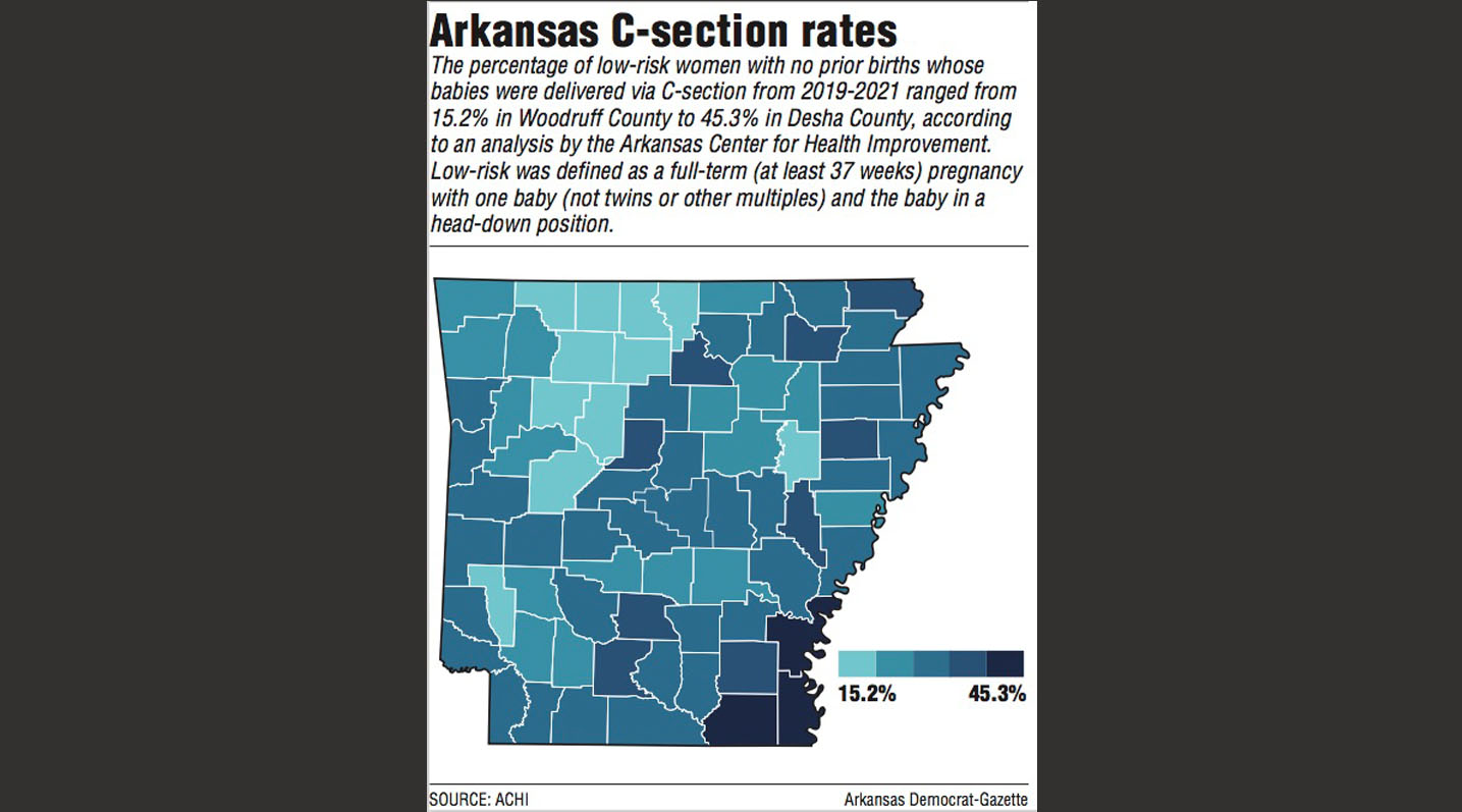Analysis finds wide variation in C-section rates in Arkansas ...