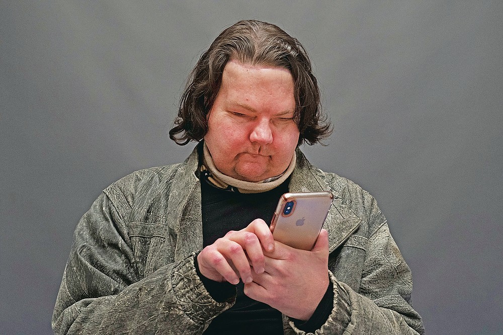 Man, 22, gets face, hands in rare surgery