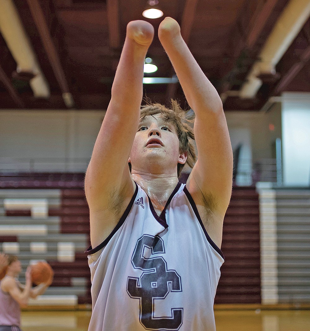 'Just watch me': Indiana basketball player has prosthetic legs and no hands