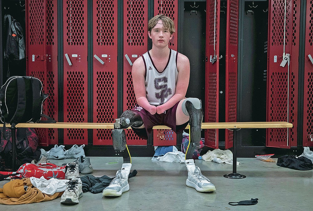 'Just watch me': Indiana basketball player has prosthetic legs and no hands