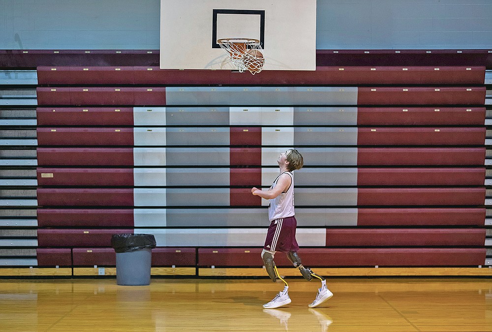 'Just watch me': Indiana basketball player has prosthetic legs and no hands