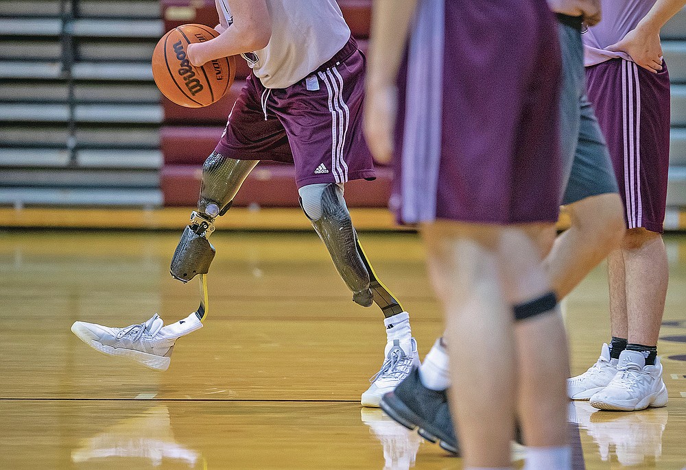 'Just watch me': Indiana basketball player has prosthetic legs and no hands