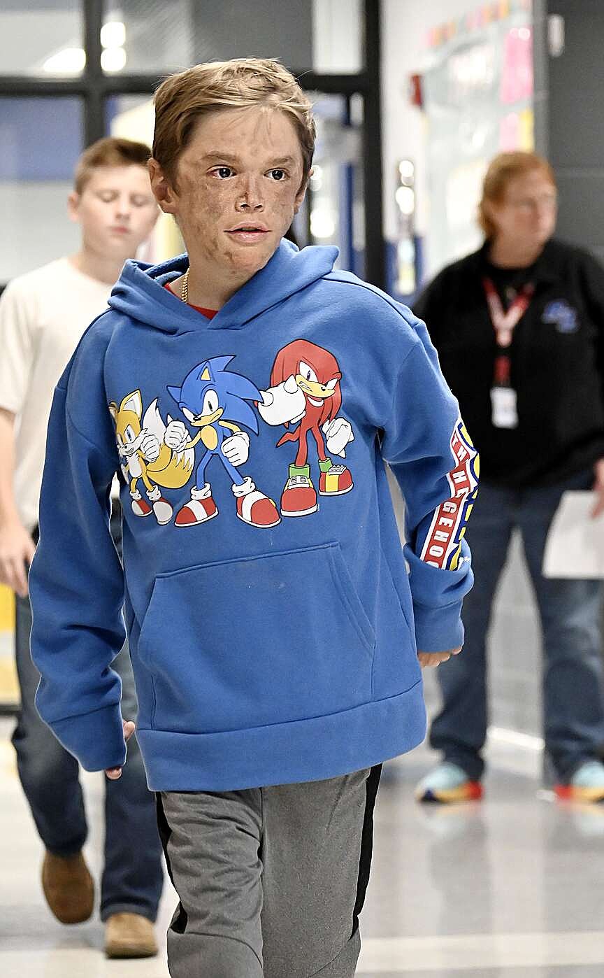 Blowing out the CANDLE: Rare genetic syndrome has taken Austin Taylor ...