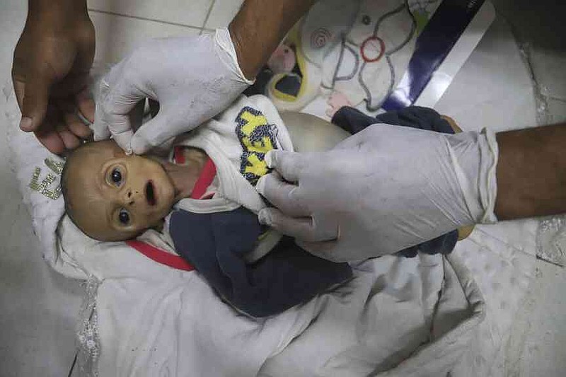Baby’s death by starvation highlights situation in Gaza | Northwest ...