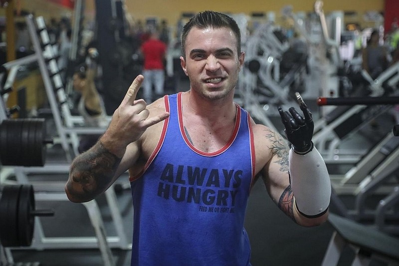 WATCH: Man who had $150K prosthetic arm stolen in Fla. competes on ...