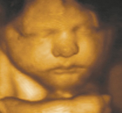 3d babies | Chattanooga Times Free Press