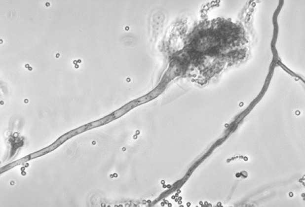 Pharmacist blamed in deadly meningitis outbreak is arrested before ...