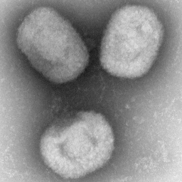 New pox discovered in Eastern Europe, but not deadly | Chattanooga ...
