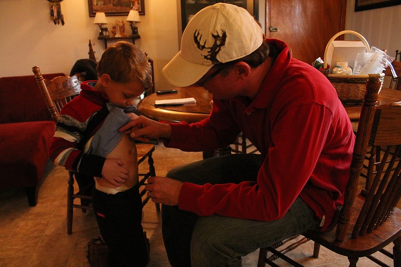 North Georgia 5-year-old battles Hirschsprung's, raises awareness ...